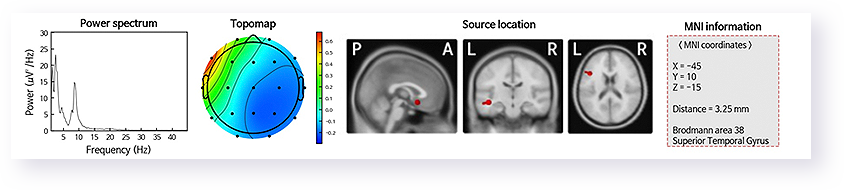 Brain Mapping – Angeles Mental Health
