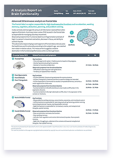 Brain Mapping – Angeles Mental Health